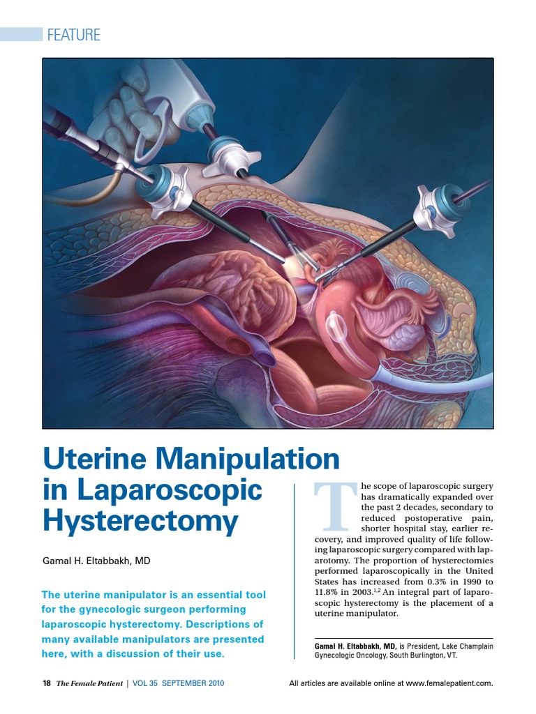 Uterine Manipulators in Laparoscopic Hysterectomy | PDF | Uterus ...