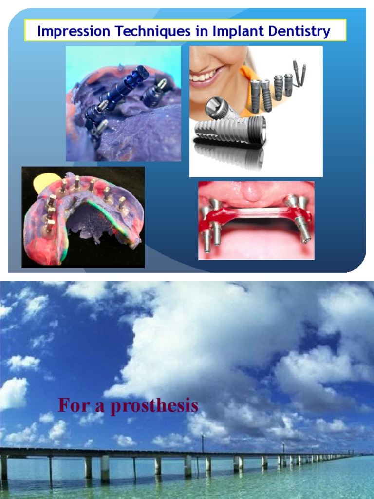 Impression Techniques In Implants Pdf Dental Implant Dentistry