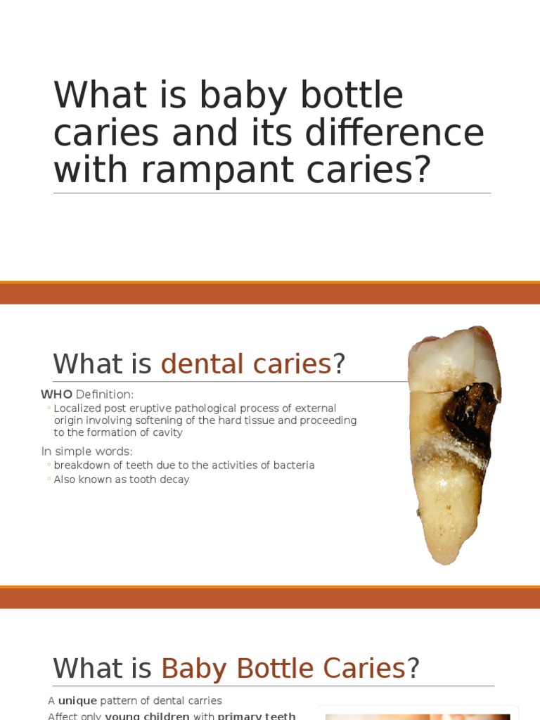What is Baby Bottle Caries and Its Difference | Human Tooth | Dentistry