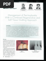Catalog Frialit Xive | PDF | Dental Implant | Prosthesis