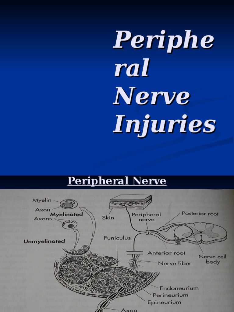 Peripheral Nerve Injury | PDF | Nerve | Neurobiology