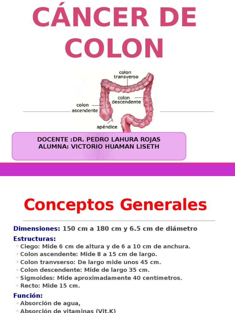 Pólipos y cáncer de colon: guía visual | PDF | Cáncer colonrectal | Cáncer