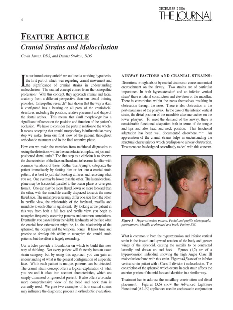 Cranial Strains and Malocclusion | PDF | Skull | Anatomical Terms Of ...