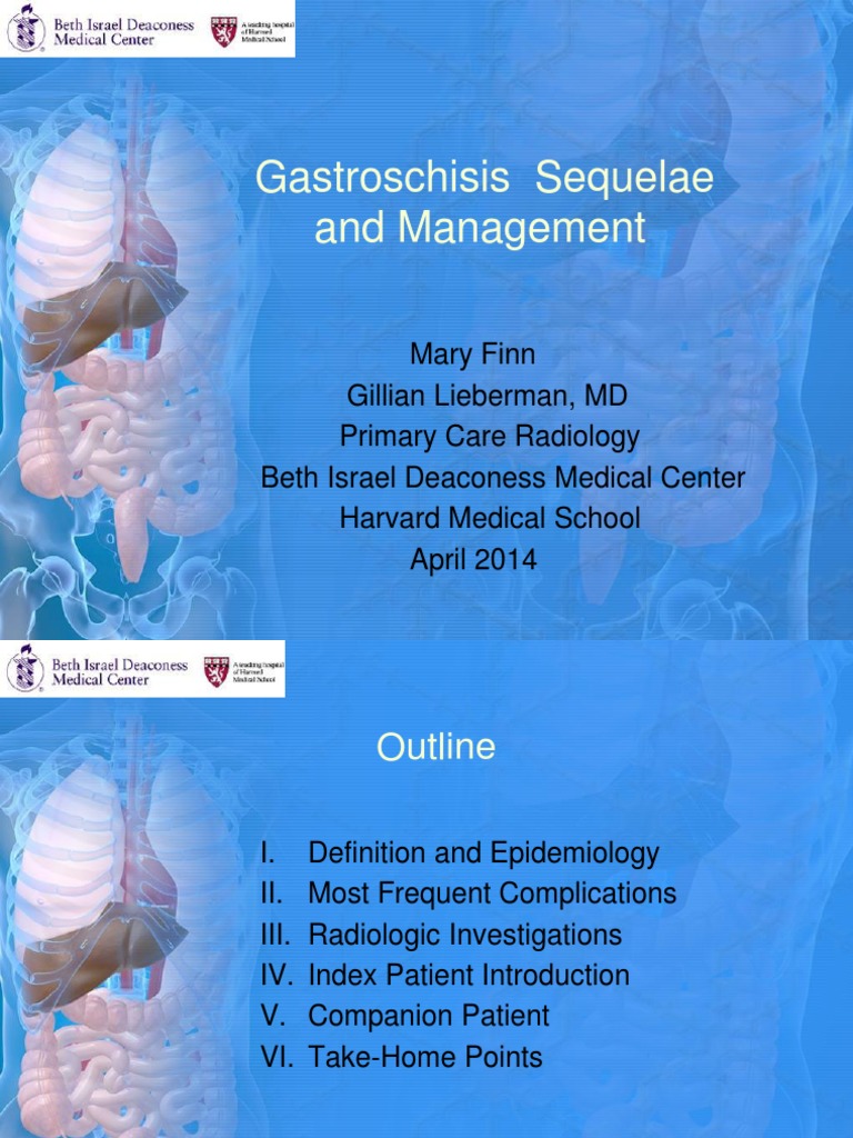Management of Gastroschisis: A Review of Complications, Imaging ...