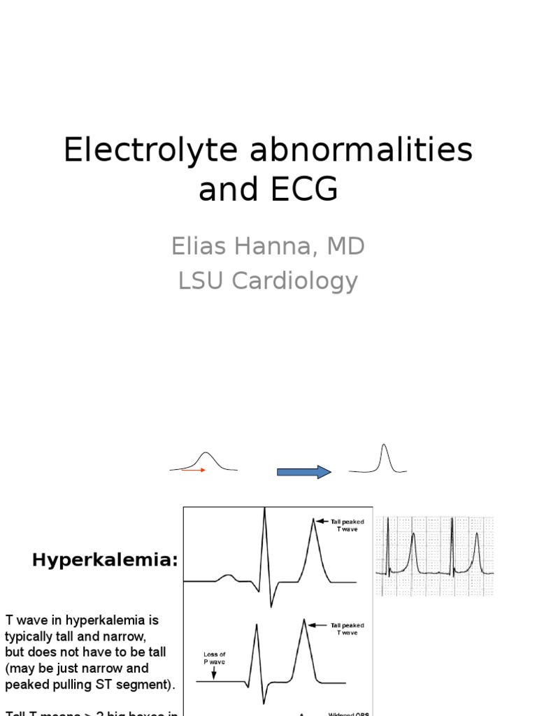Electrolyte Abnormalities and ECG: Elias Hanna, MD LSU Cardiology | PDF