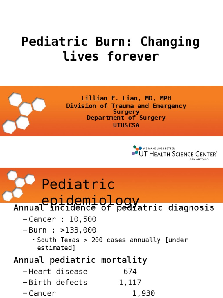 Pediatric Burns Powerpoint | Burn | Major Trauma