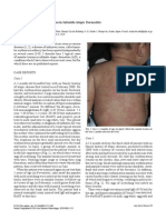 Hanifin and Rajka Diagnostic Criteria For Atopic Dermatitis | PDF ...