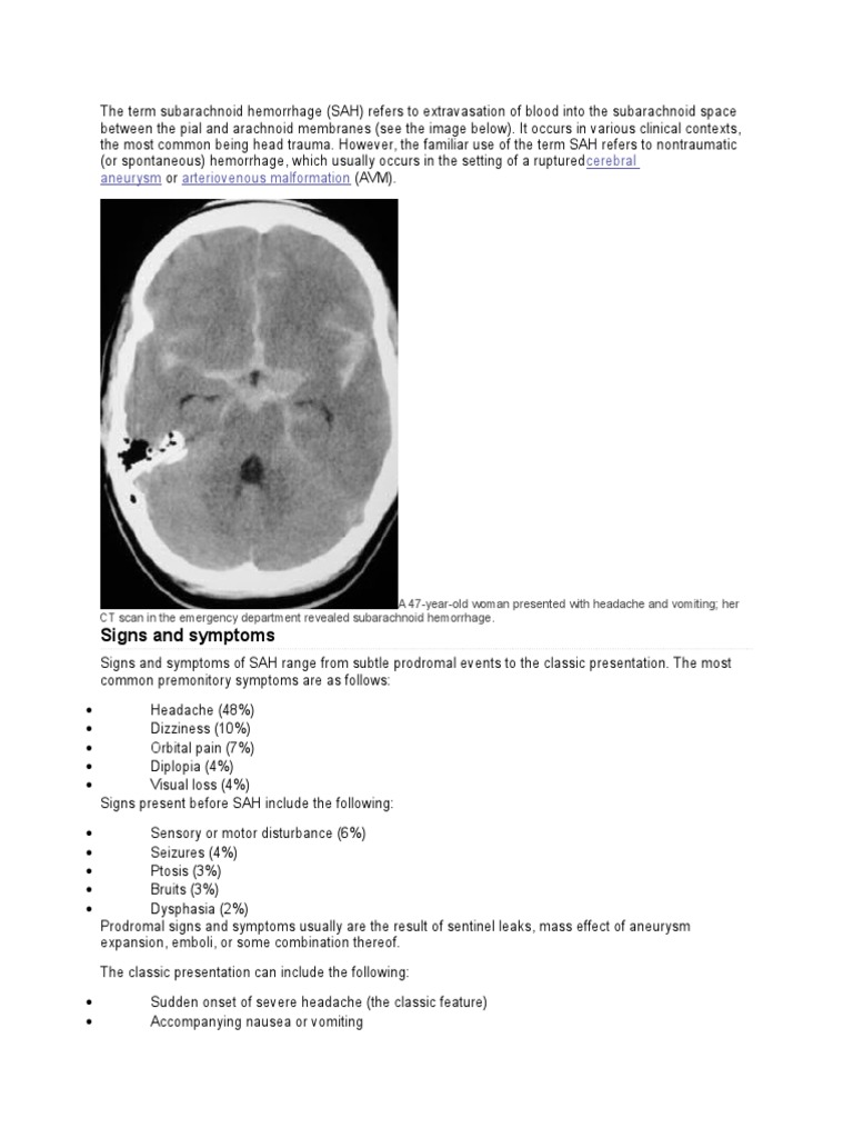 Cerebral Aneurysm Arteriovenous Malformation: Signs and Symptoms | PDF | Angiography | Headache