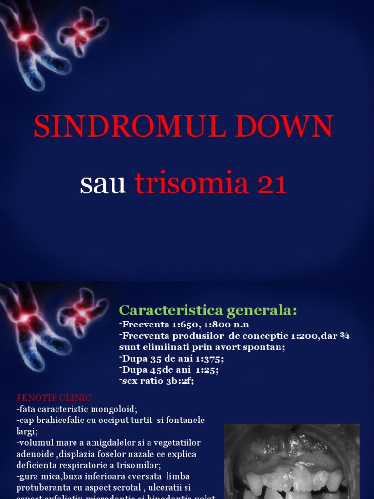 Sindromul Down | PDF