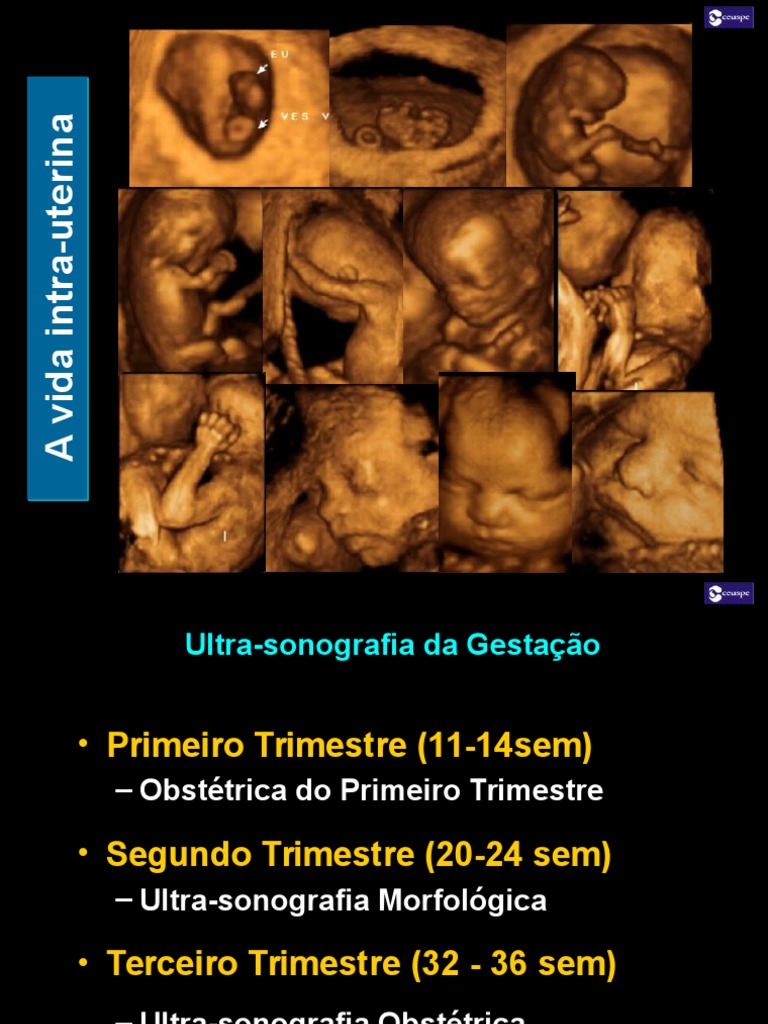 08-Ultrassonografia em Obstetricia | PDF | Gravidez | Anatomia