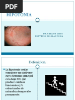 Tecnica Faco+lio+vitrectomia+retinopexia | PDF | Catarata | Oftalmología
