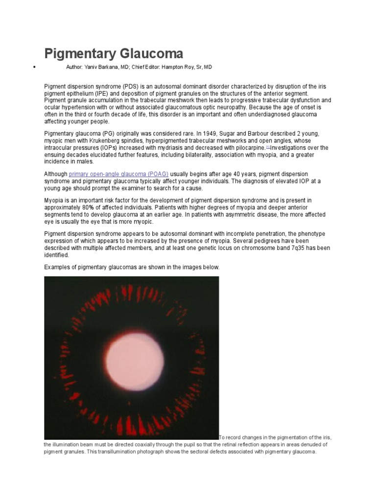 Pigmentary Glaucoma | PDF | Glaucoma | Ophthalmology