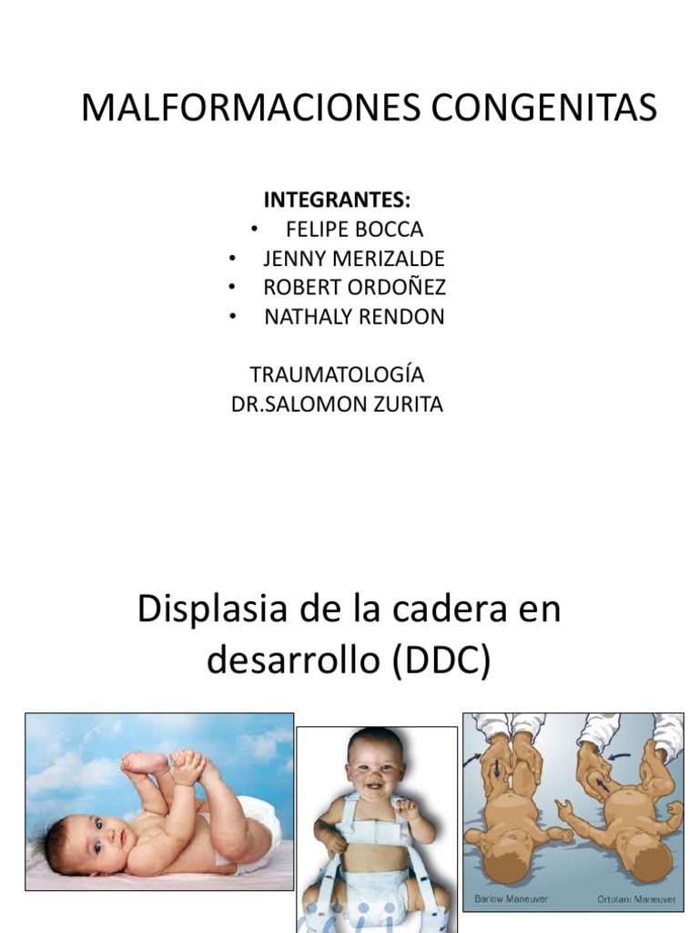 Malformaciones Congénitas en Traumatología | PDF | Pie | Extremidades ...