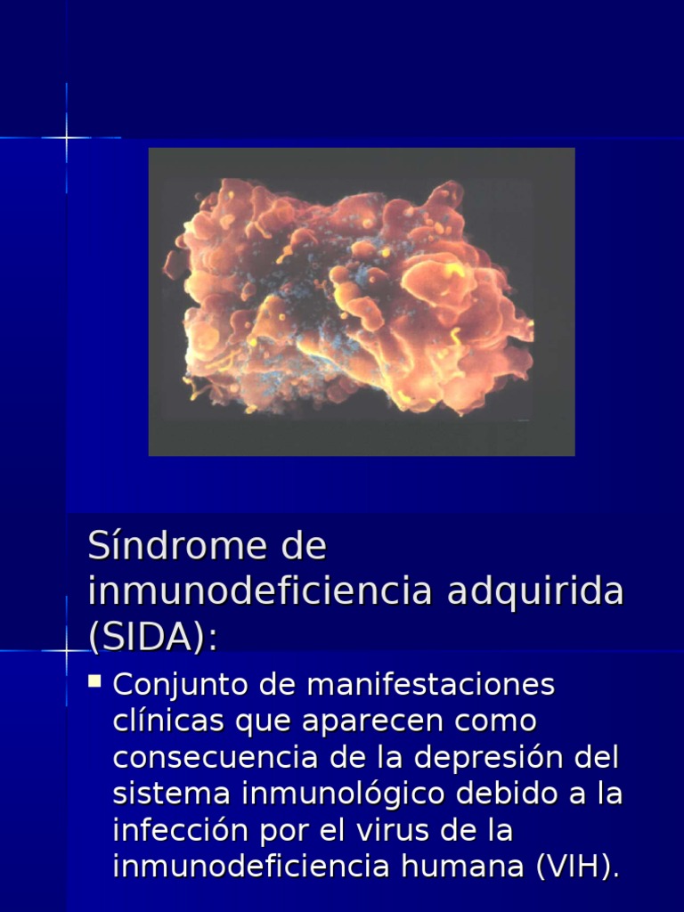 Síndrome de Inmunodeficiencia Adquirida (SIDA): | VIH/sida | VIH