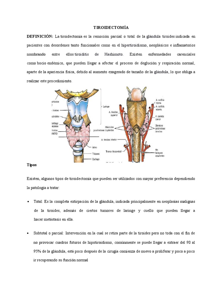 TIROIDECTOMIA | Tiroides | Medicina CLINICA