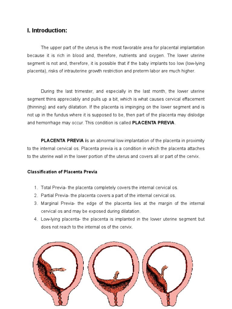Case Study (Placenta Previa) | PDF | Uterus | Fetus
