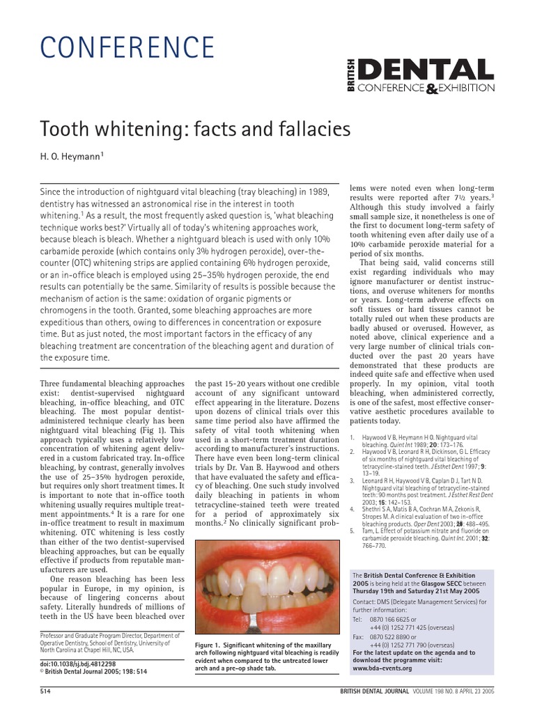 Conference: Tooth Whitening: Facts and Fallacies | PDF | Dentistry | Mouth