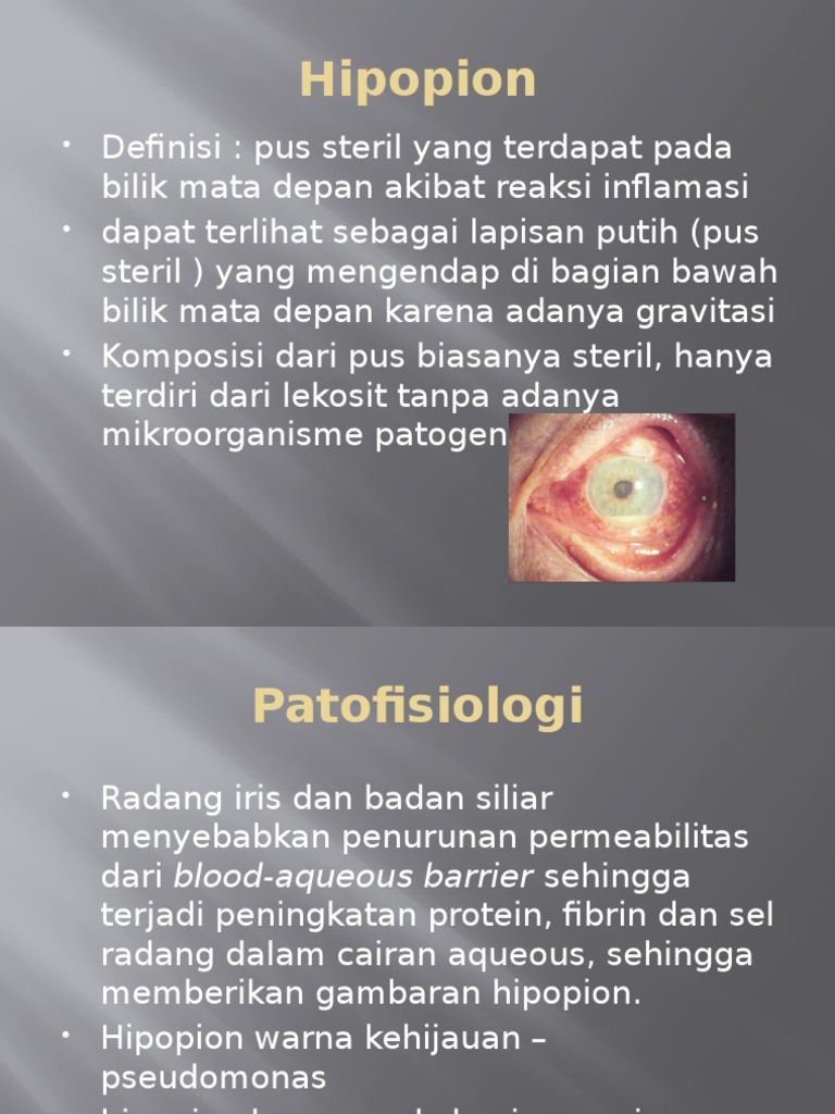 Panduan Hipopion untuk Medis | PDF