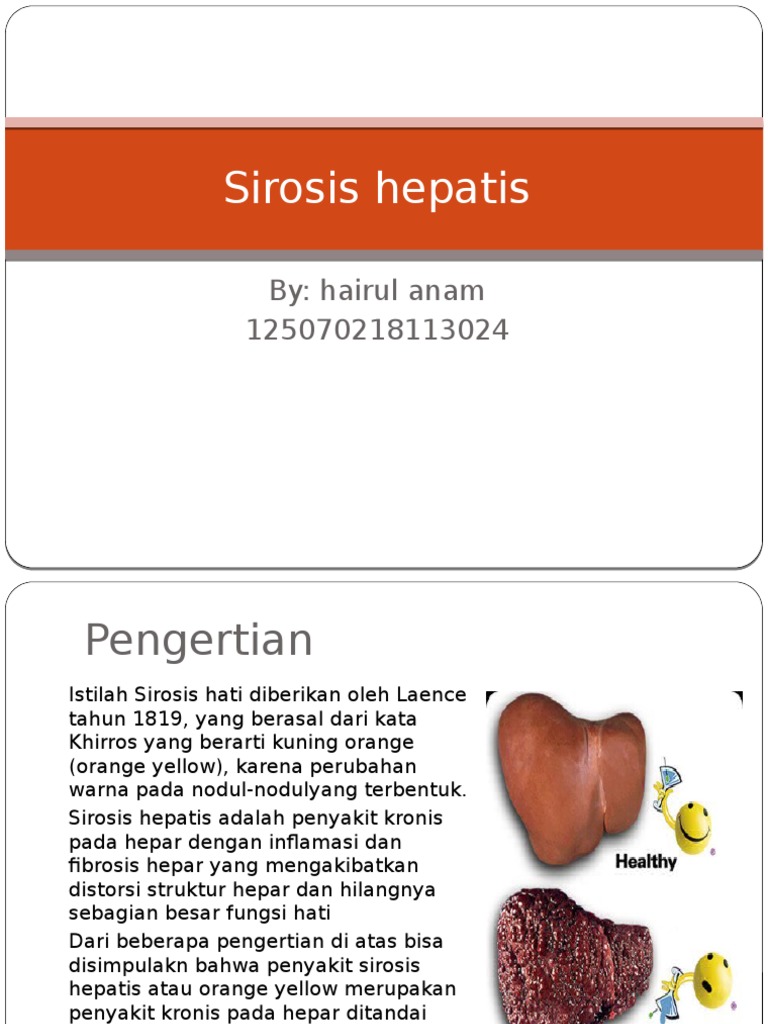 Sirosis Hepatis | PDF