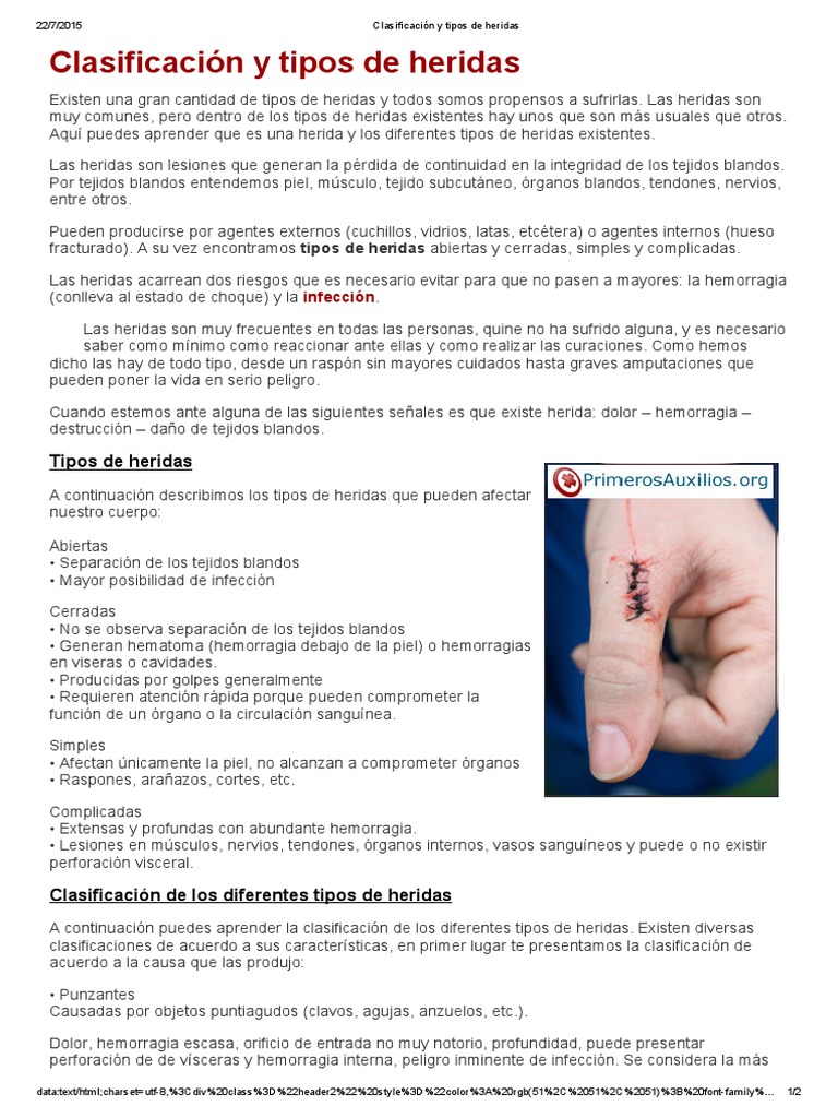 Clasificación y Tipos de Heridas | Herida | Piel