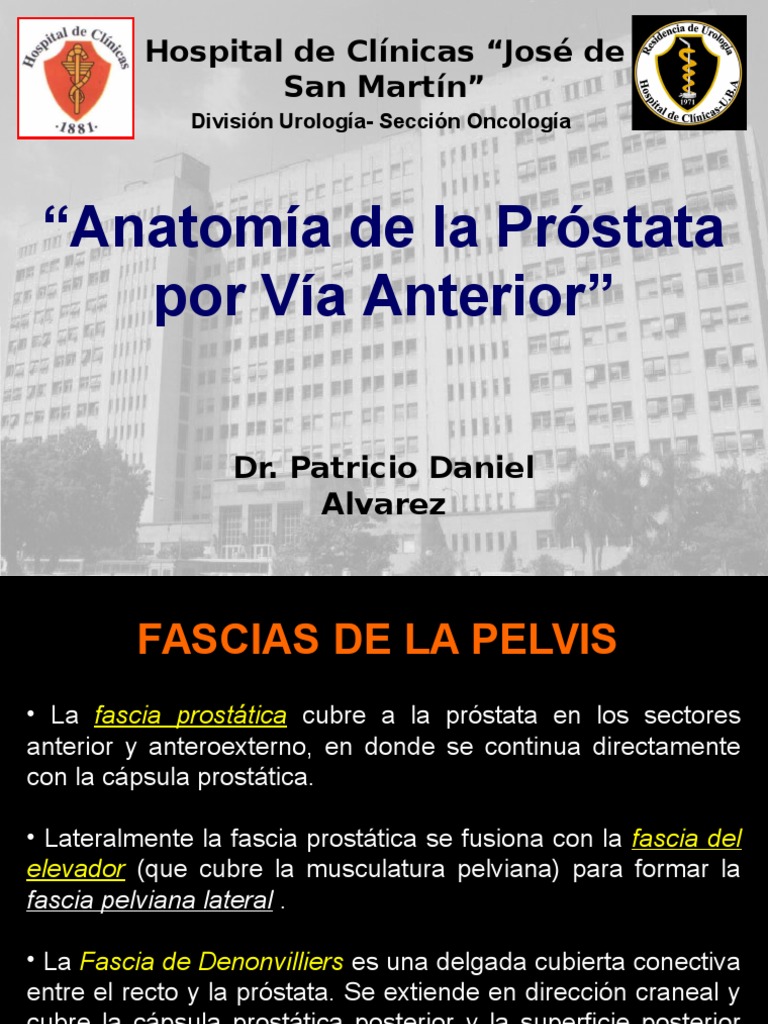 Anatomia Prostatica via Anterior