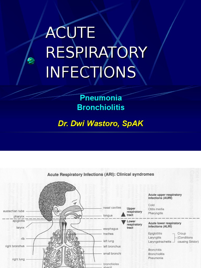 Acute Respiratory Infection.PPT | Pneumonia | Microbiology