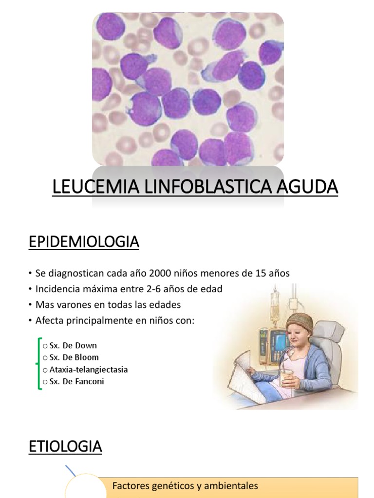Leucemia Linfoblastica Aguda | PDF | Leucemia | Inmunología