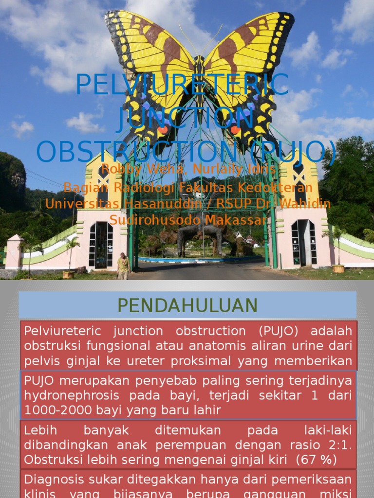 Pelviureteric Junction Obstruction (Pujo) | PDF | Sains & Matematika
