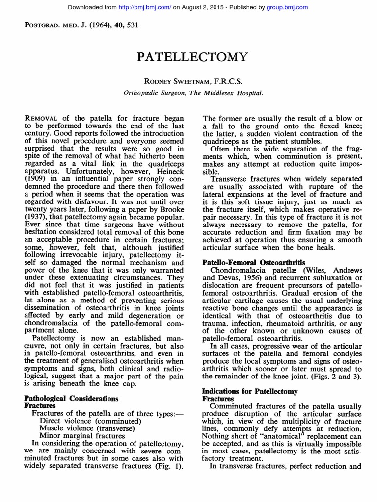 patellectomy | Knee | Osteoarthritis