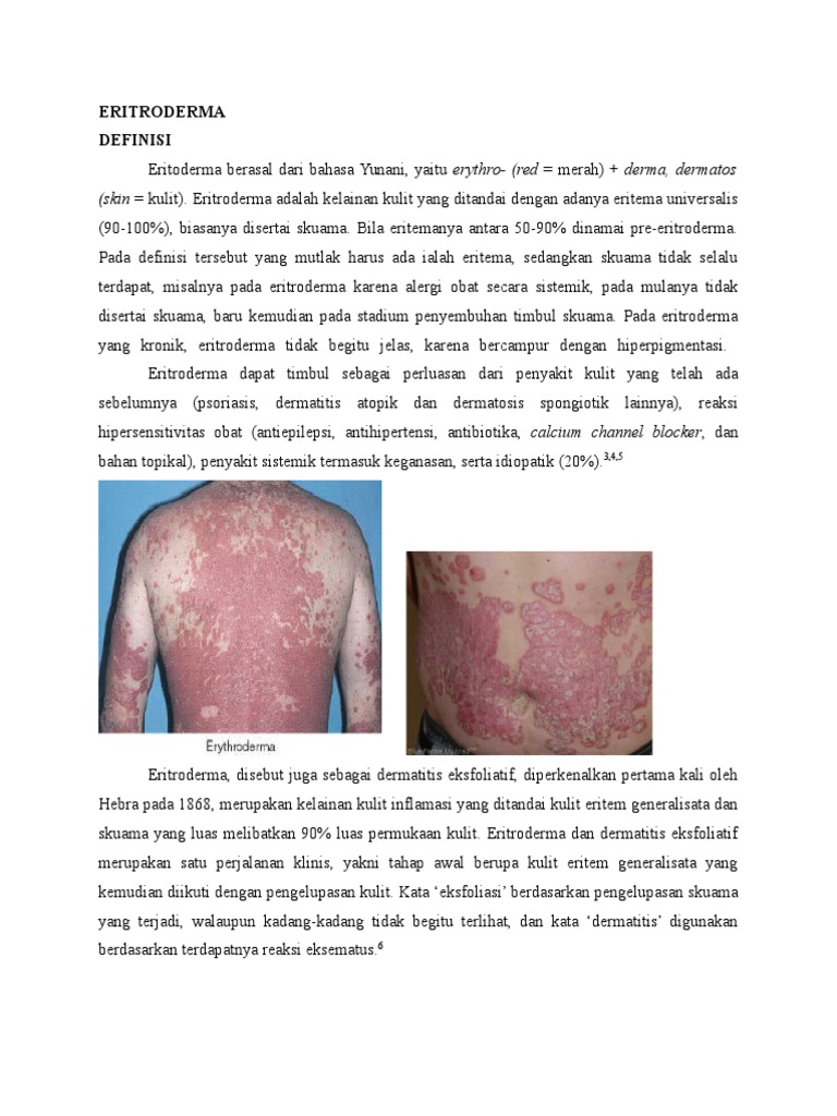 ERITRODERMA | PDF