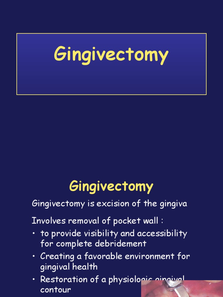 Gingivectomy | Healing | Medical Specialties