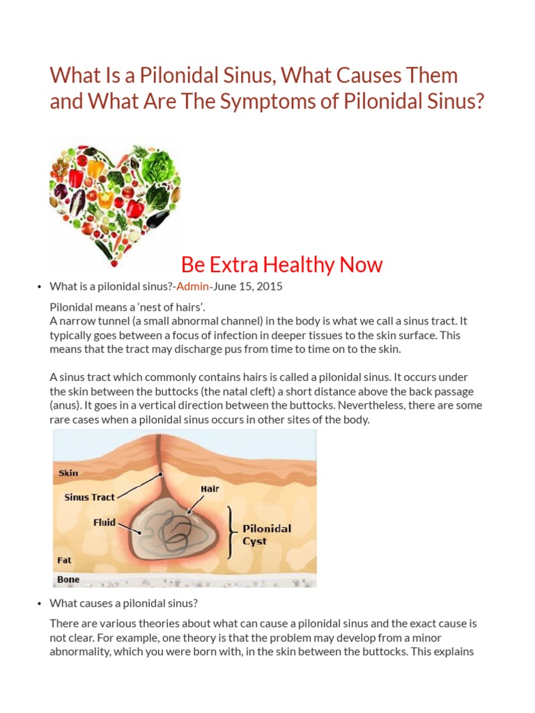 What Is A Pilonidal Sinus, What Causes Them and What Are The Symptoms ...