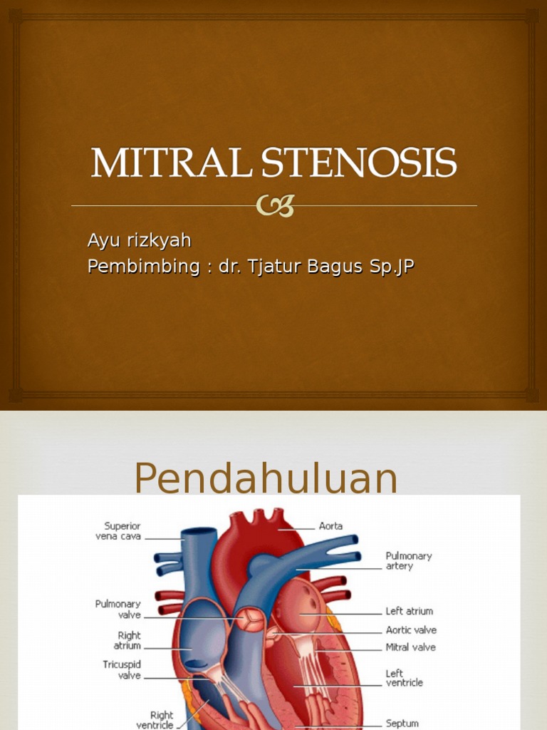 Mitral Stenosis | PDF