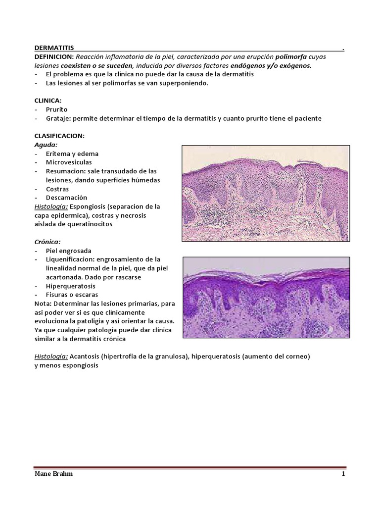 dermatitis.pdf | Alergia | Inflamación