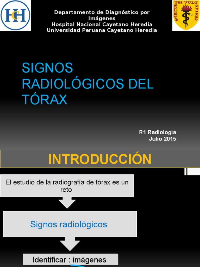 Signos Radiológicos Del Torax | Descargar gratis PDF | Pulmón | Tórax