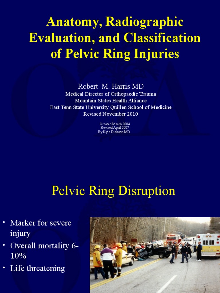 Anatomy, Radiographic Evaluation, and Classification of Pelvic Ring ...