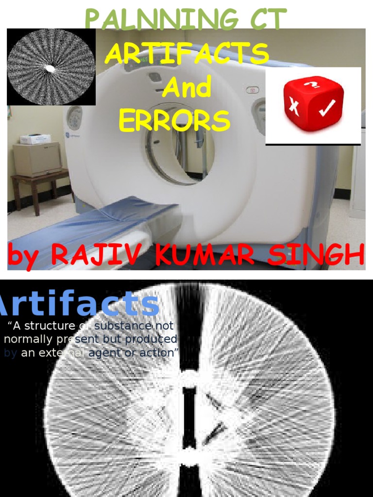 Artifacts in CT and Errors | Download Free PDF | Ct Scan | Applied And ...