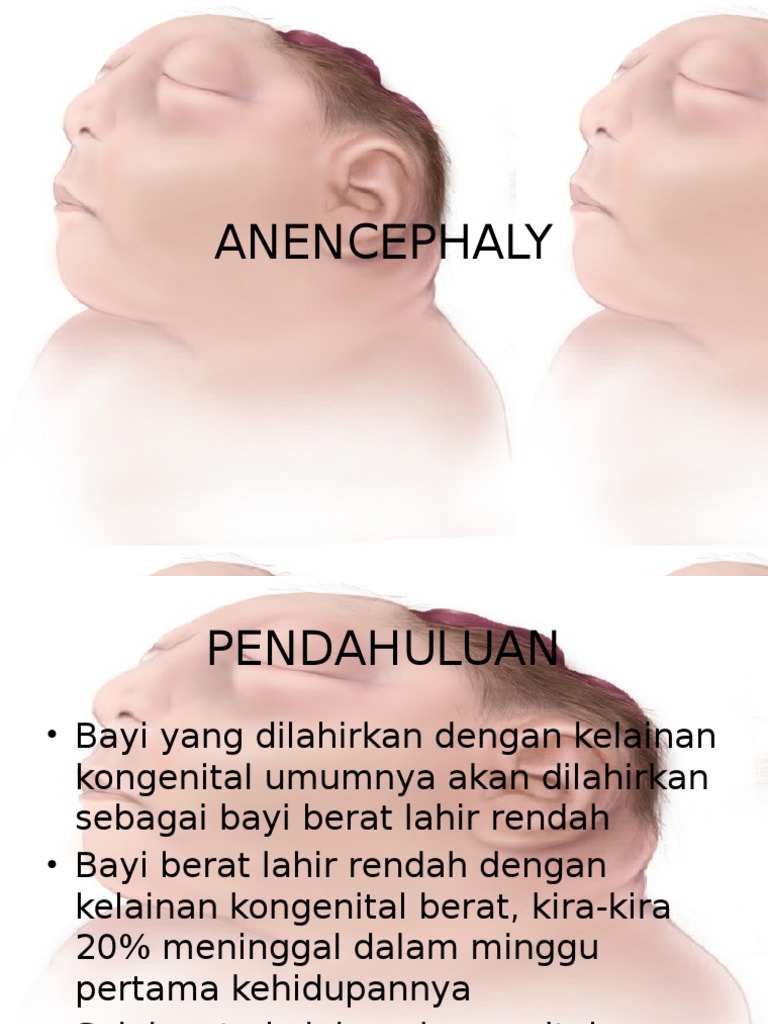 ANENCEPHALY | PDF | Sains & Matematika | Gaya Hidup