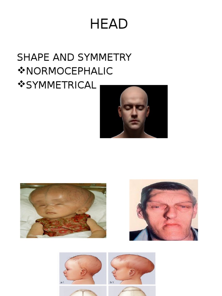 Shape and Symmetry Normocephalic Symmetrical | PDF