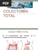 C 37 Cecostomia Colostomia | PDF | Intestino grueso | Abdomen