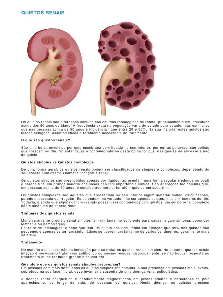 Quistos Renais | PDF | Rim | Especialidades médicas