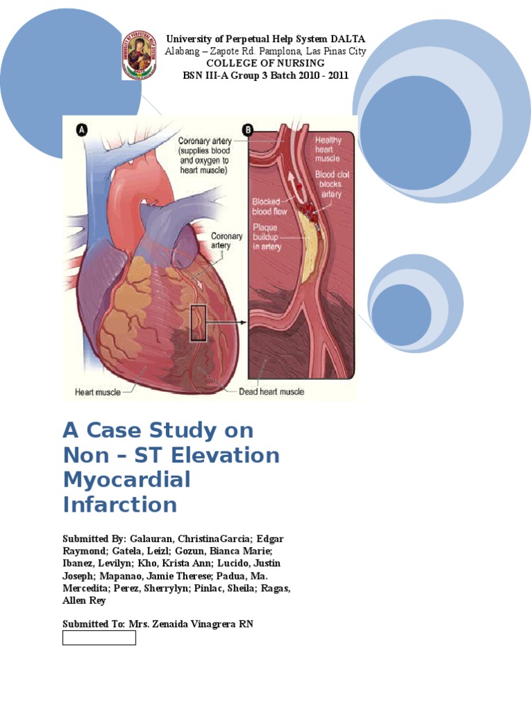 Case Study NSTEMI | PDF | Heart Valve | Myocardial Infarction