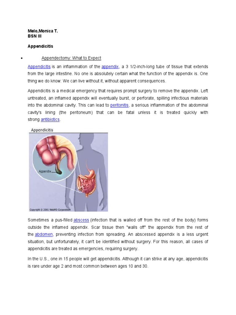 Melo, Monica T. BSN Iii Appendicitis | PDF | Medical Specialties | Clinical Medicine