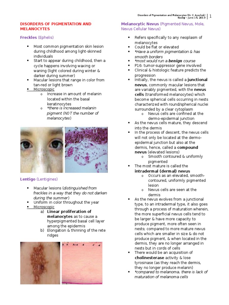 Disorders of Pigmentation and Melanocytes | Melanoma | Cutaneous Conditions