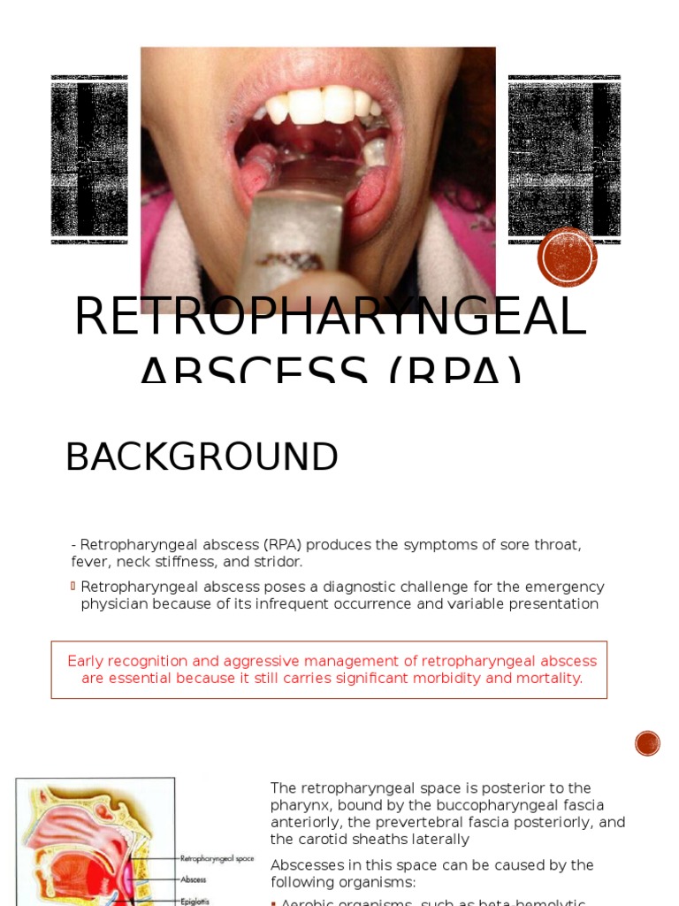 Retropharyngeal Abscess Overview | PDF | Streptococcus | Sepsis