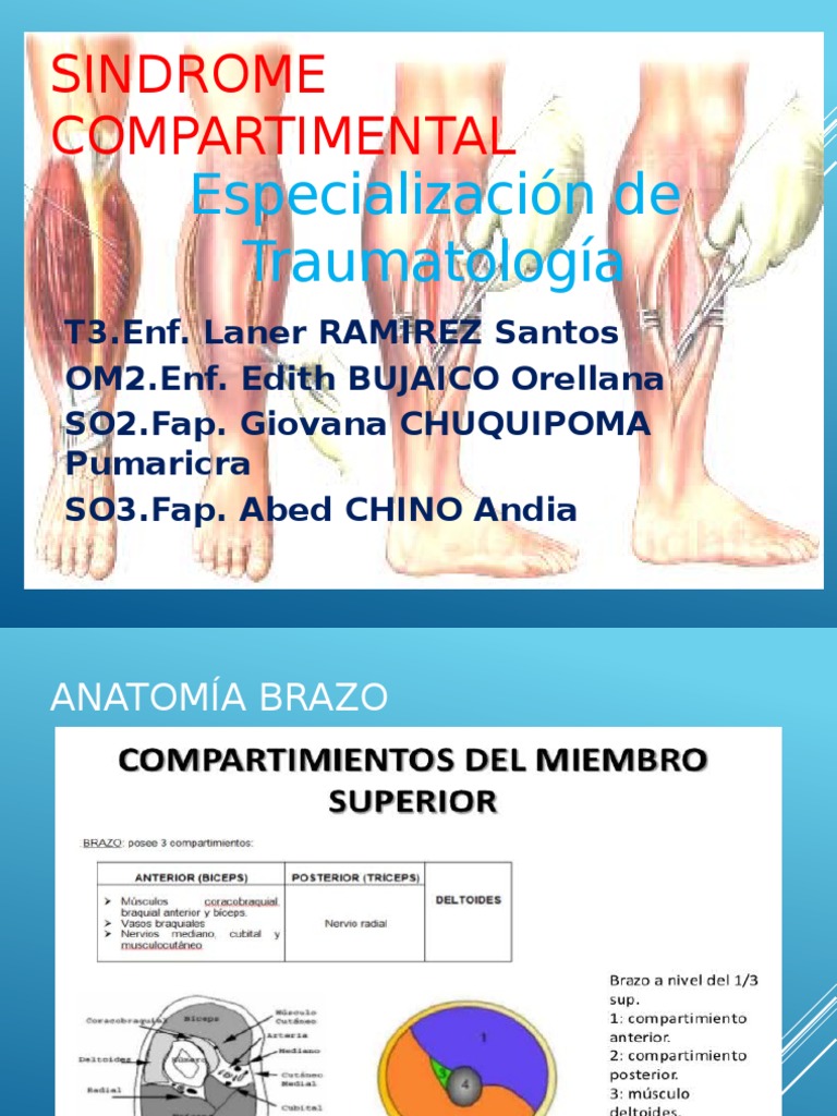 Sindrome Compartimental | Mano | Anatomía humana