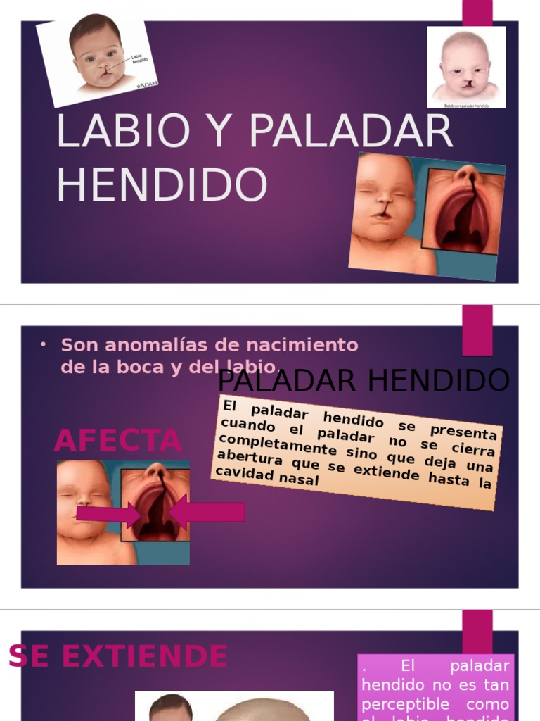 Labio y Paladar Hendido | PDF | Enfermedades y trastornos humanos ...