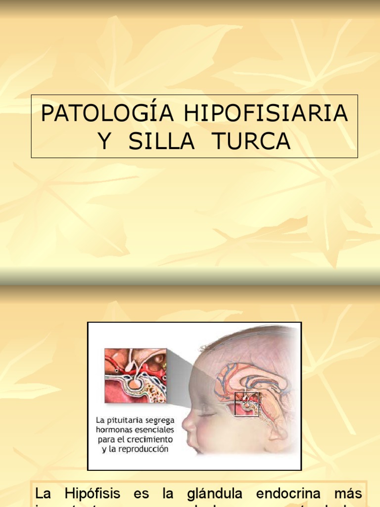 155257413-Silla-Turca | Glándula pituitaria | Hormona