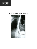 Exames Contrastados: Esofagografia Detalhada | PDF | Vômito | Esôfago