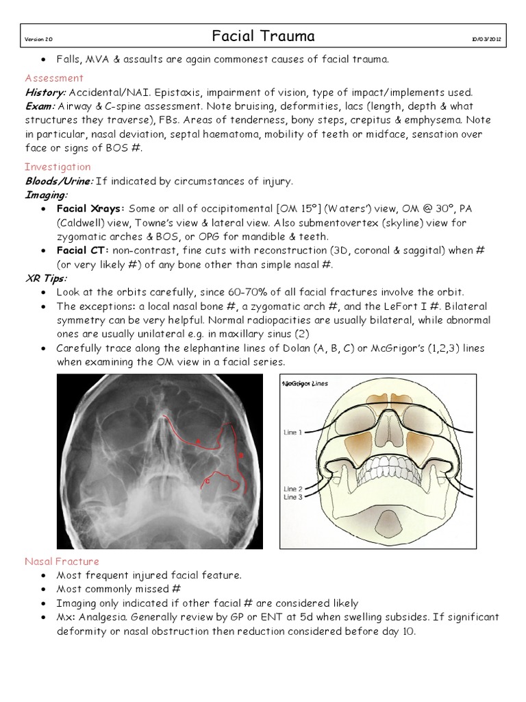 Facial Trauma.pdf | Human Head And Neck | Face